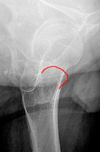 Becken / Hüfte Arzt | OrthoRad